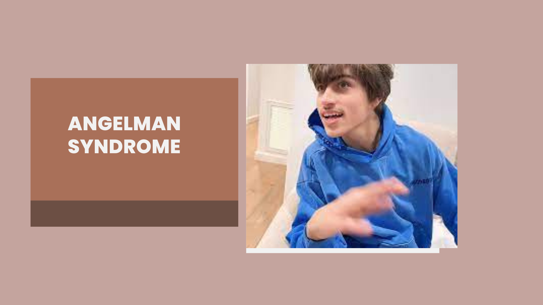 Angelman Syndrome: Research and Colin Farrell’s Personal Story